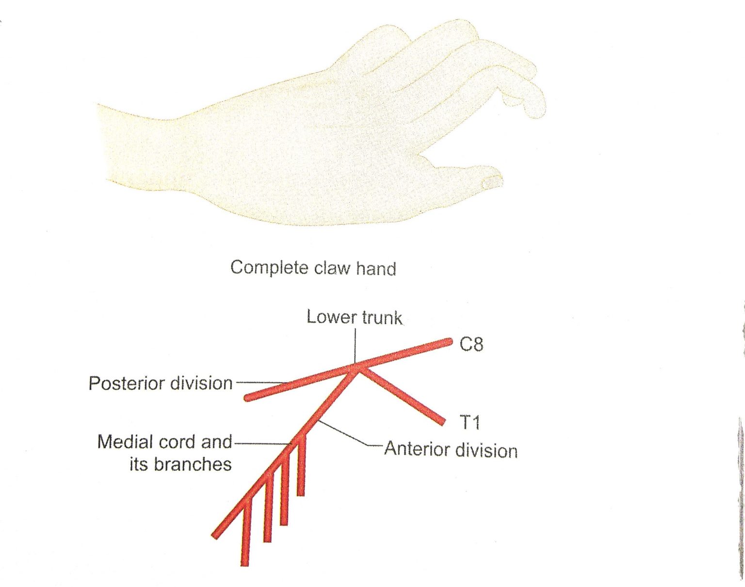 BRACHIAL PLEXUS